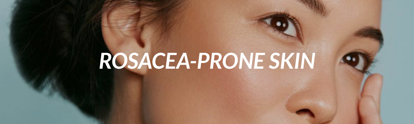 Rosacea-Prone Skin - Skin Type