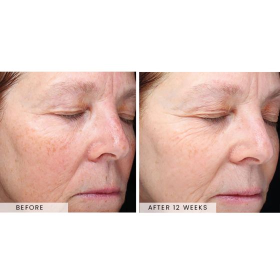 Skinbetter Science A-Team Duo Kit | McGuiness Dermatology: Aesthetic ...